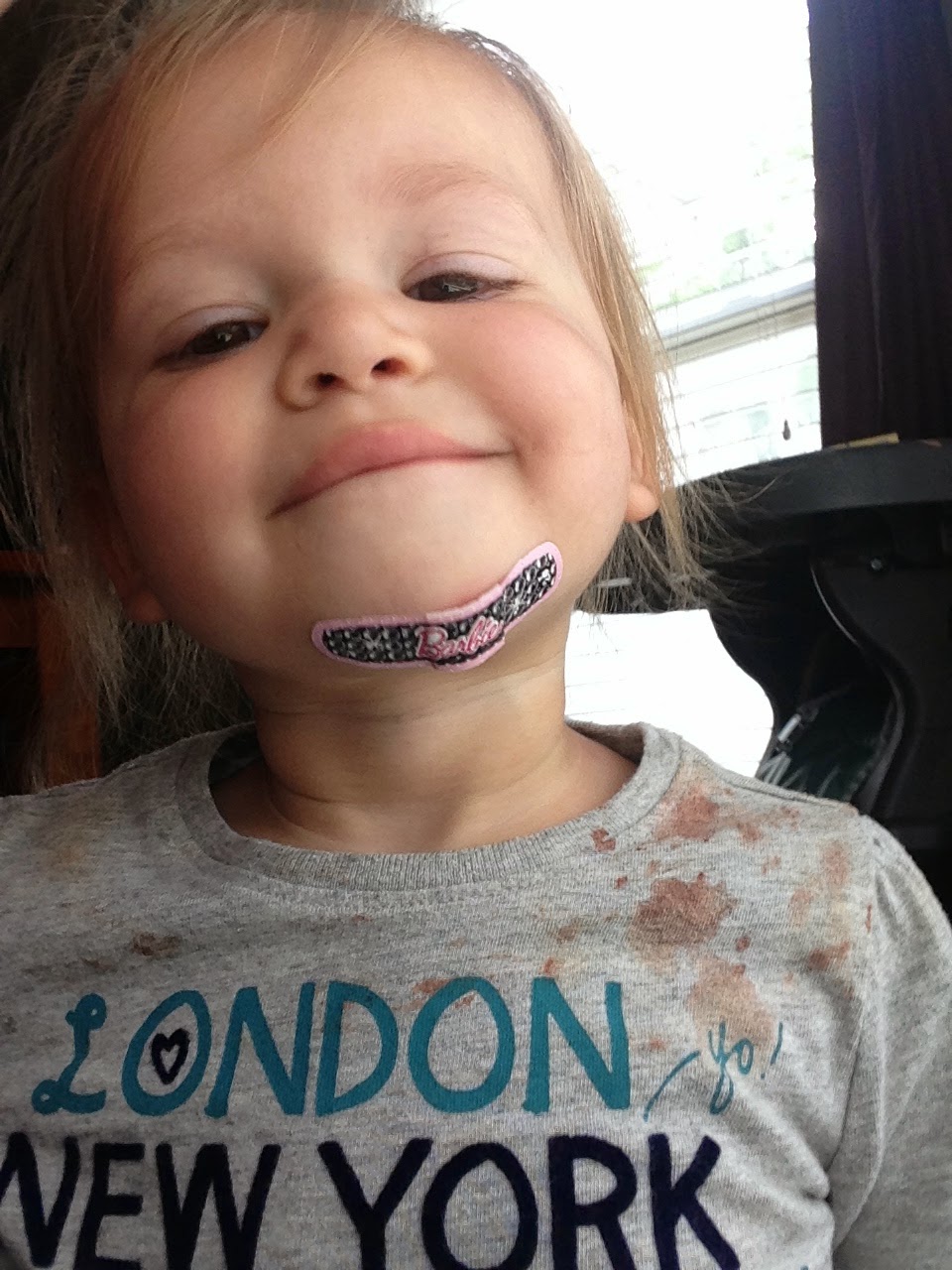 Daily Ava: Today Ava Busted Open Her Chin